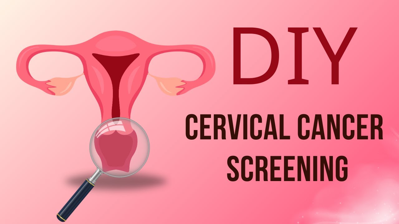 DIY Cervical Cancer Screening: The Future of Women's Health Care - YouTube