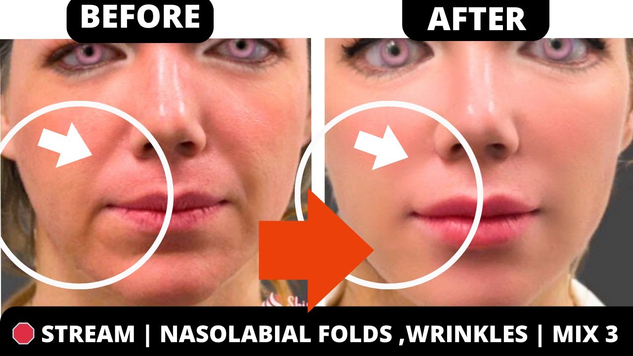 FACE LIFTING EXERCISES FOR SMILE LINES (NASOLABIAL FOLDS) JOWLS, SAGGY ...