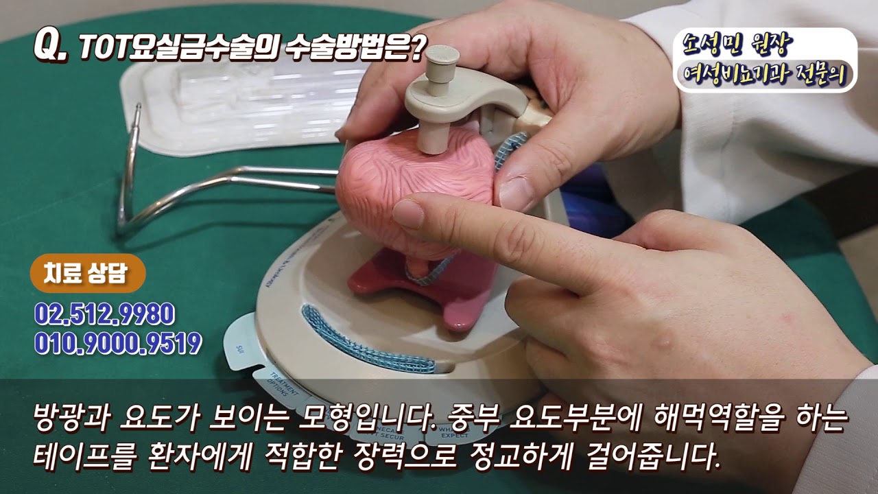 포웰의원 요실금수술 TOT 수술방법 간단하게 살펴보기 - YouTube