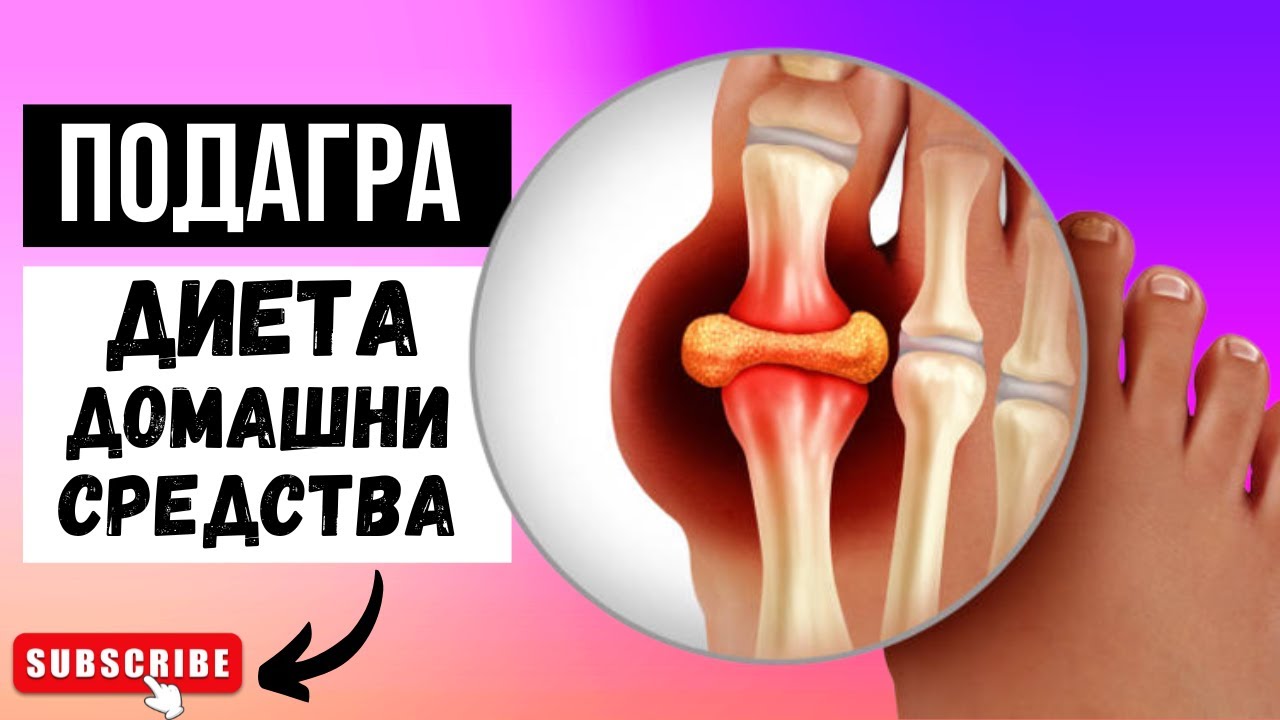 ИСТИНАТА за подаграта КАК да намалите пикочната киселина Храните