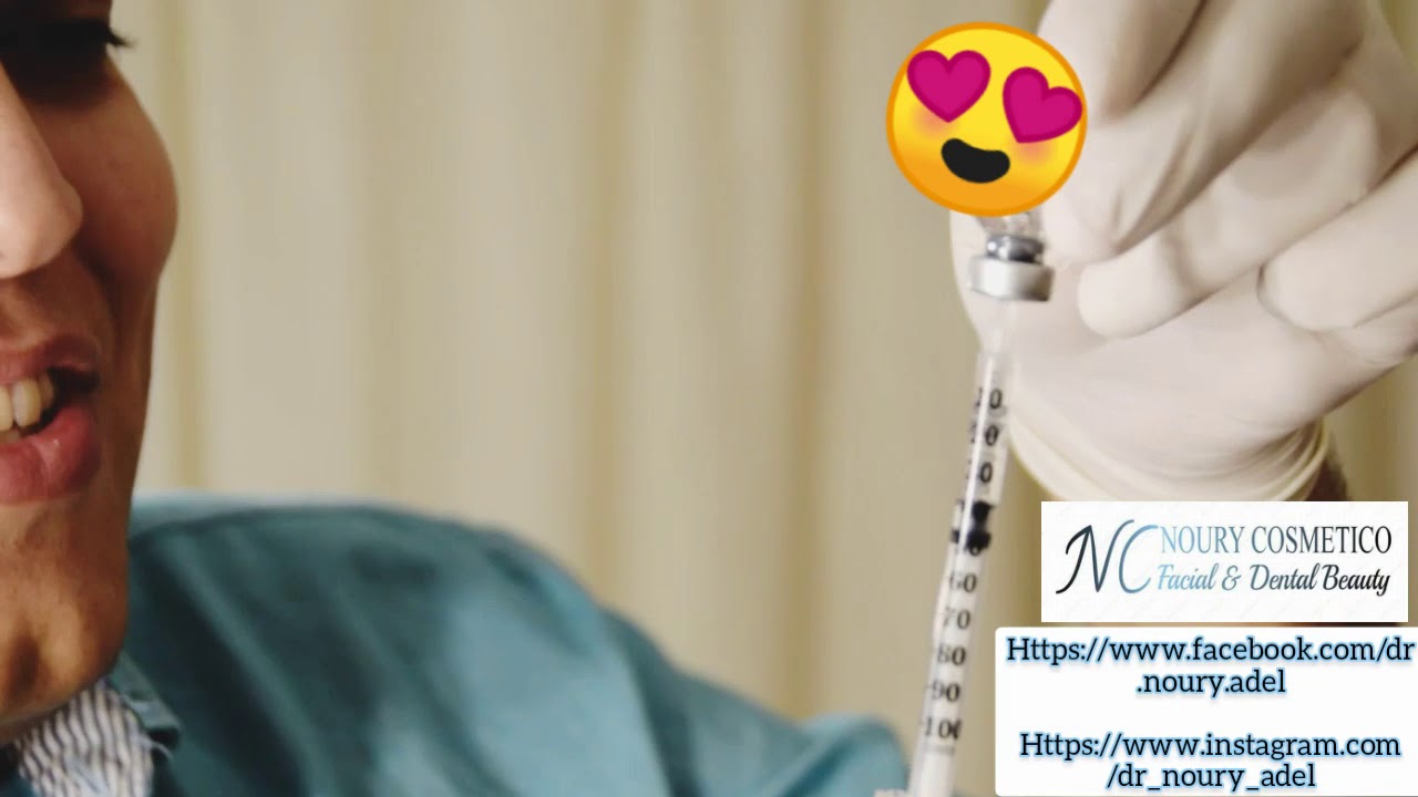 Botox injection for a mixed gummy smile case - Dr Noury Adel - YouTube