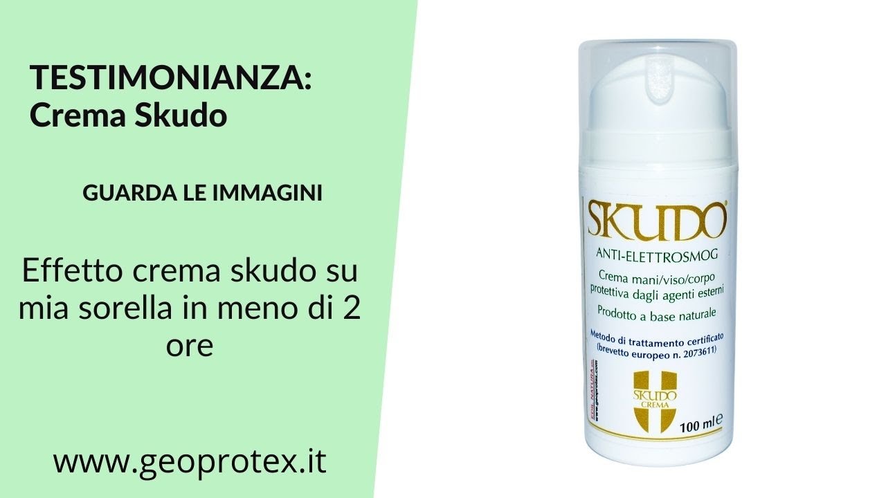 Irritazione alle mani trattata con Crema Skudo - YouTube