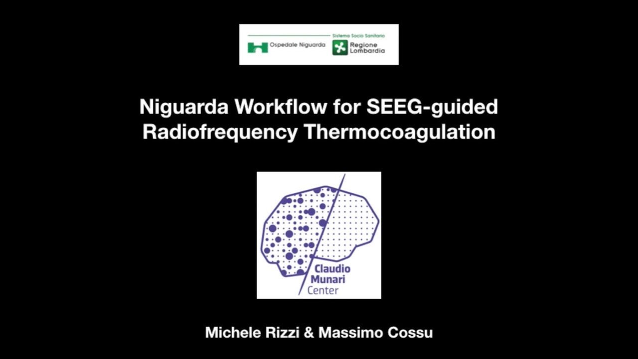 Niguarda Workflow for SEEG-guided Radiofrequency Thermocoagulation ...