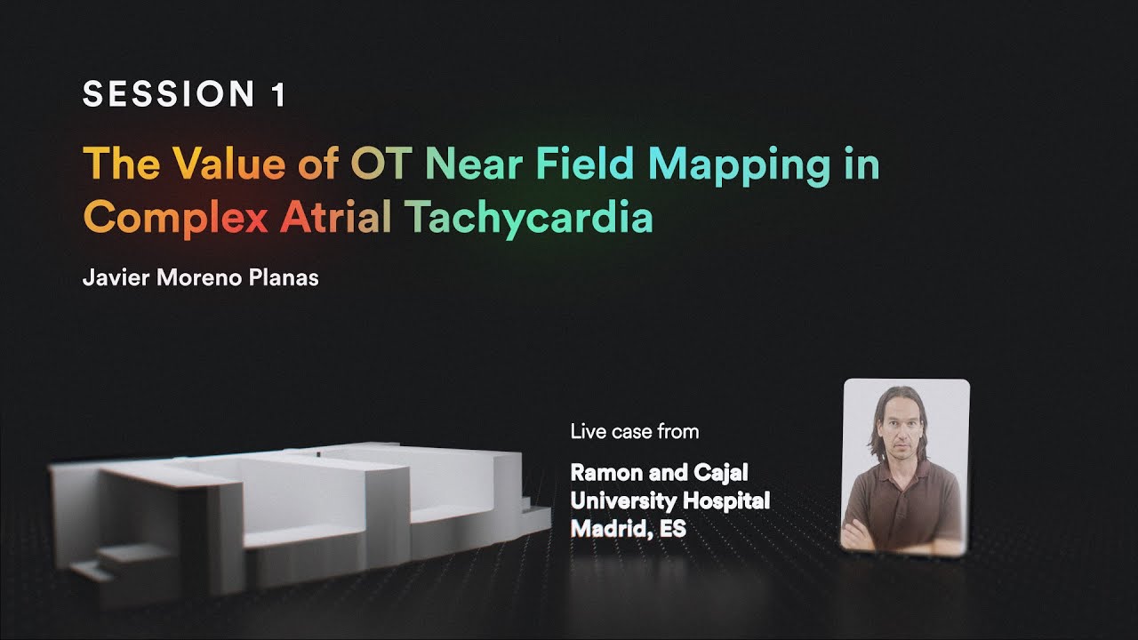 Discover the Value of OT Near Field Mapping in Complex Atrial ...