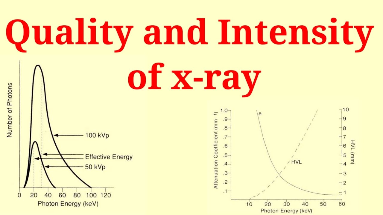 Quality and Intensity of x-ray in Hindi || #xray #drt #mri - YouTube