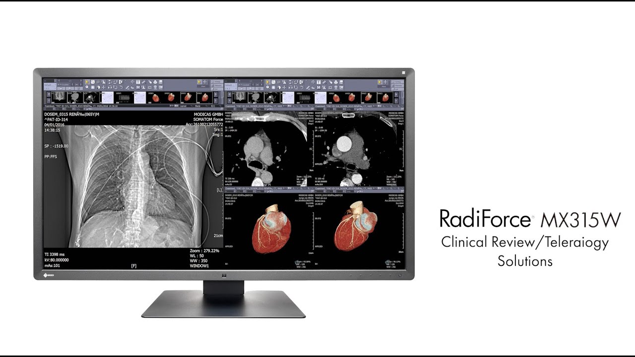 MX315 ProductDemo RSNA2020 - YouTube