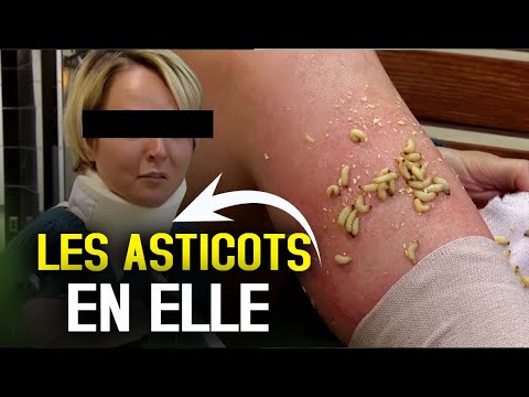 LES ASTICOT SORTENT D'ELLE.... HISTOIRE MYSTIQUE - DMG TV - YouTube