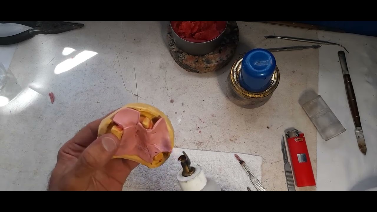 Prótesis Parcial Placa base - YouTube