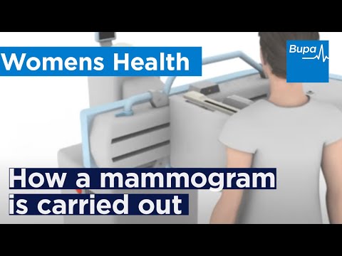 How a mammogram is carried out | Bupa Health