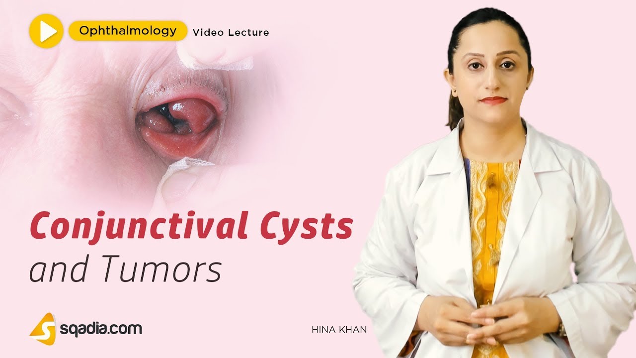 Conjunctival Cysts and Tumors | Ophthalmology Lecture - YouTube