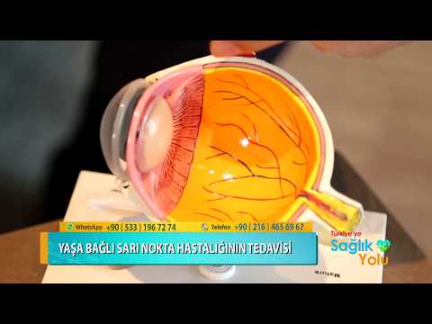 Retina Hastalıkları Nasıl Tedavi Edilir?