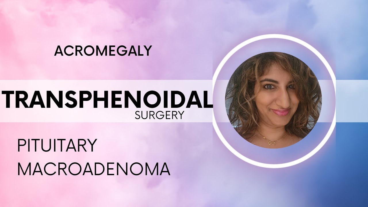 Acromegaly & Transphenoidal Surgery - YouTube