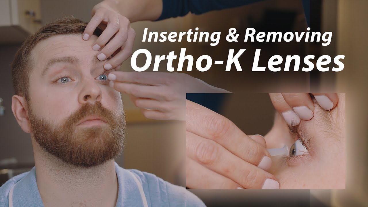 Inserting and Removing Orthokeratology (ortho-k) lenses - Village ...