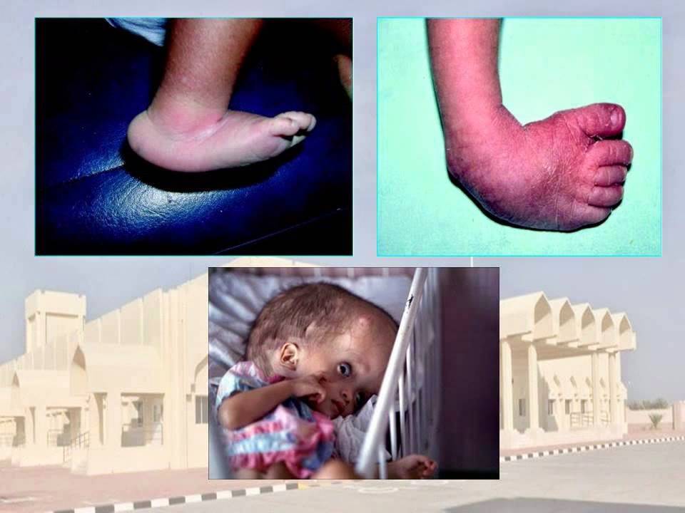 DYSMORPHOLOGY AS A PROFESSION-Dr. Musallam Said Al-Araimi - YouTube