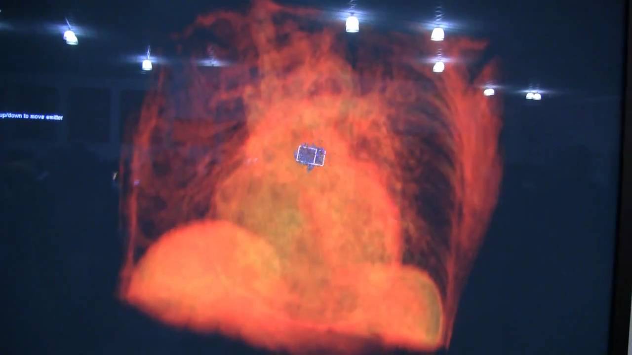 GTC 2010 - Real-time beating heart simulation for doctors shows promise ...