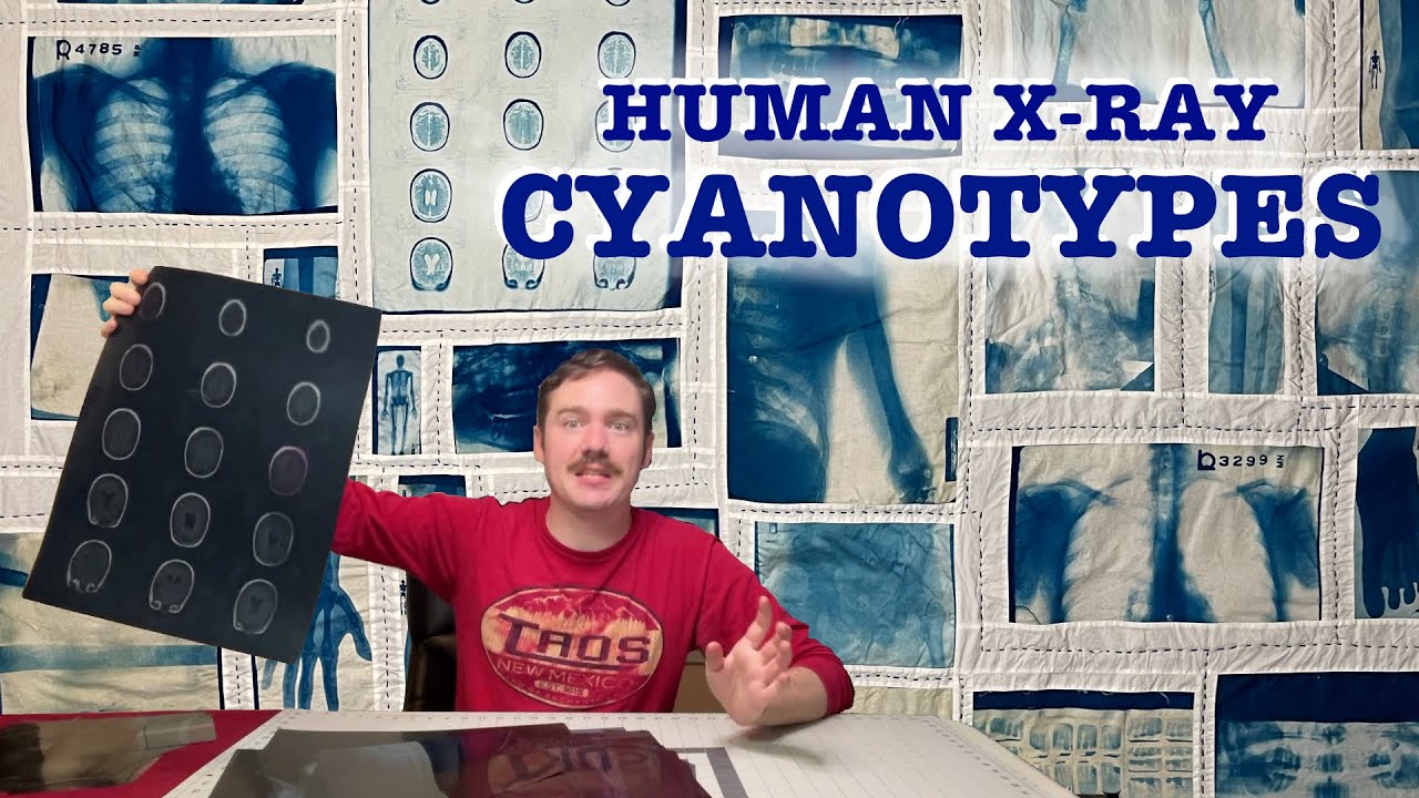 Quilt made of HUMAN X-RAYS?? Cyanotype Quilt - YouTube