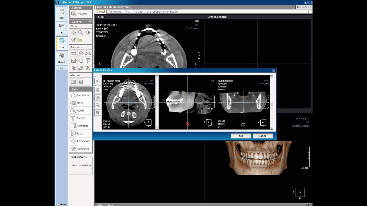Video Tutorial del programa RealScan 2.0 ve - H&T DENT - YouTube