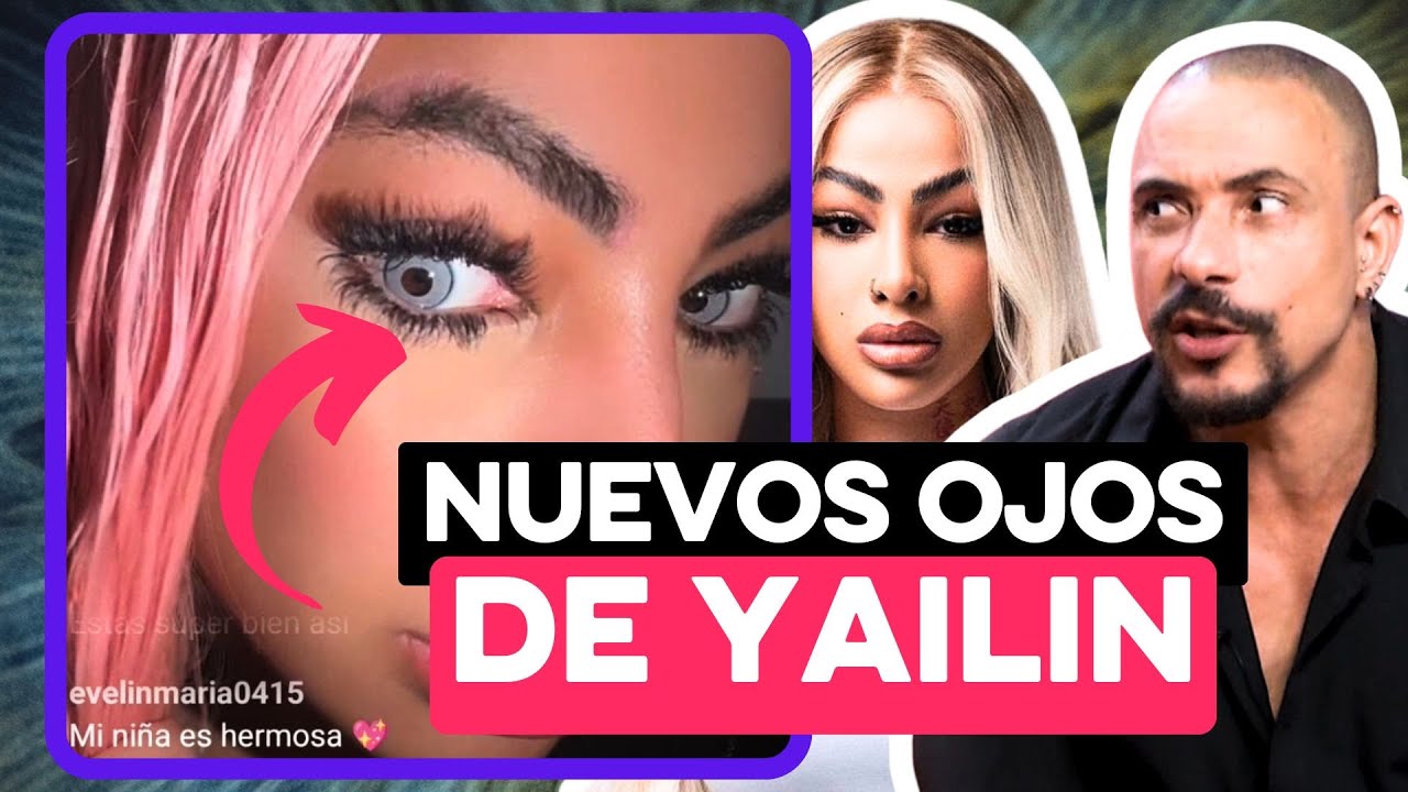 Yailin NO TEME quedar CIEGA tras operación para cambiar el color de sus ...