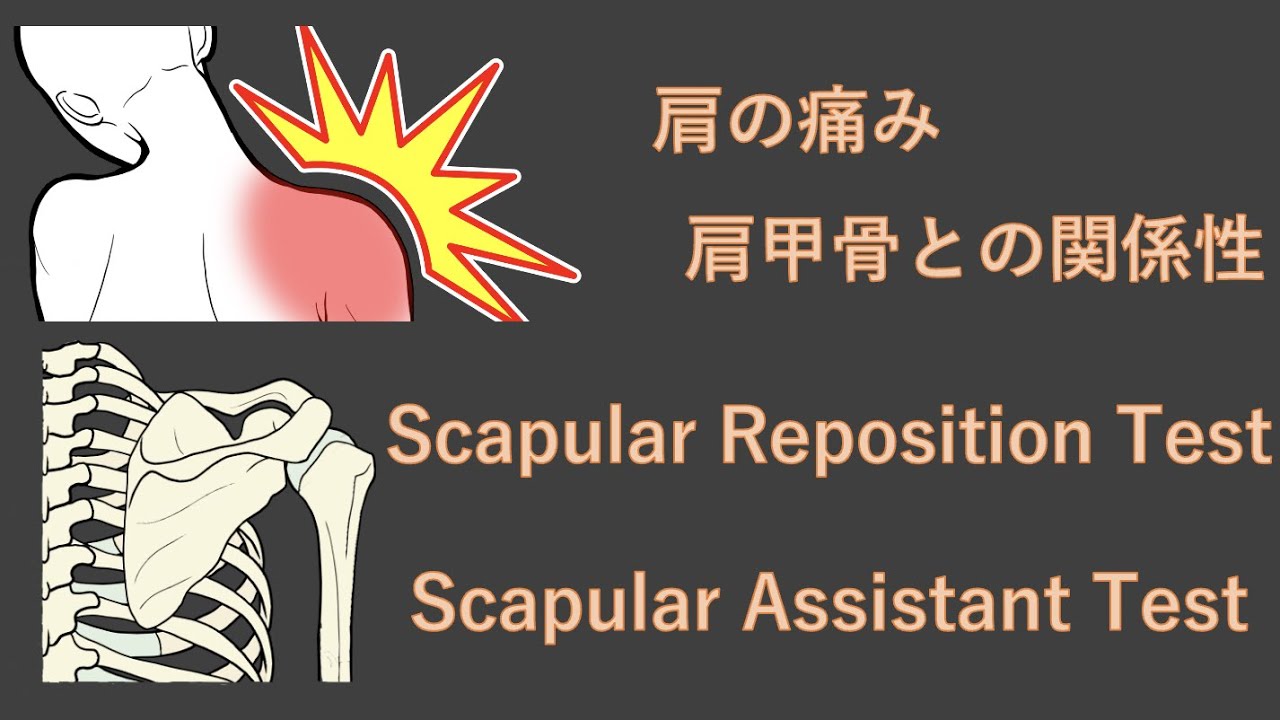 肩関節のリハビリテーション-肩の痛み（インピンジメント）と肩甲骨の関連性を調べるScapular Assistant Test ...