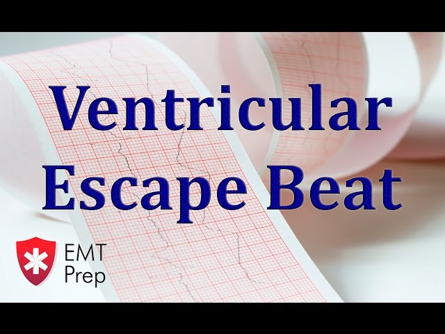 Ventricular Escape Rhythm