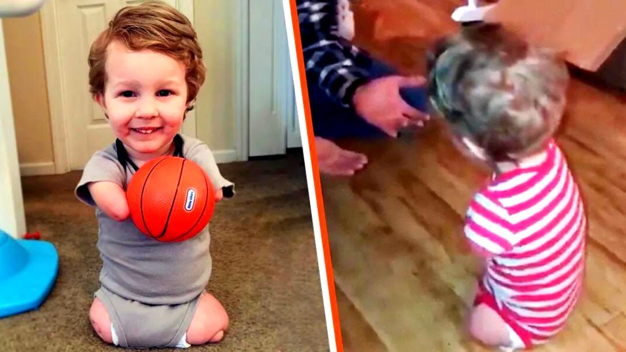 Texas Boy Born without Arms and Legs Takes First Steps at 4, Doctors ...