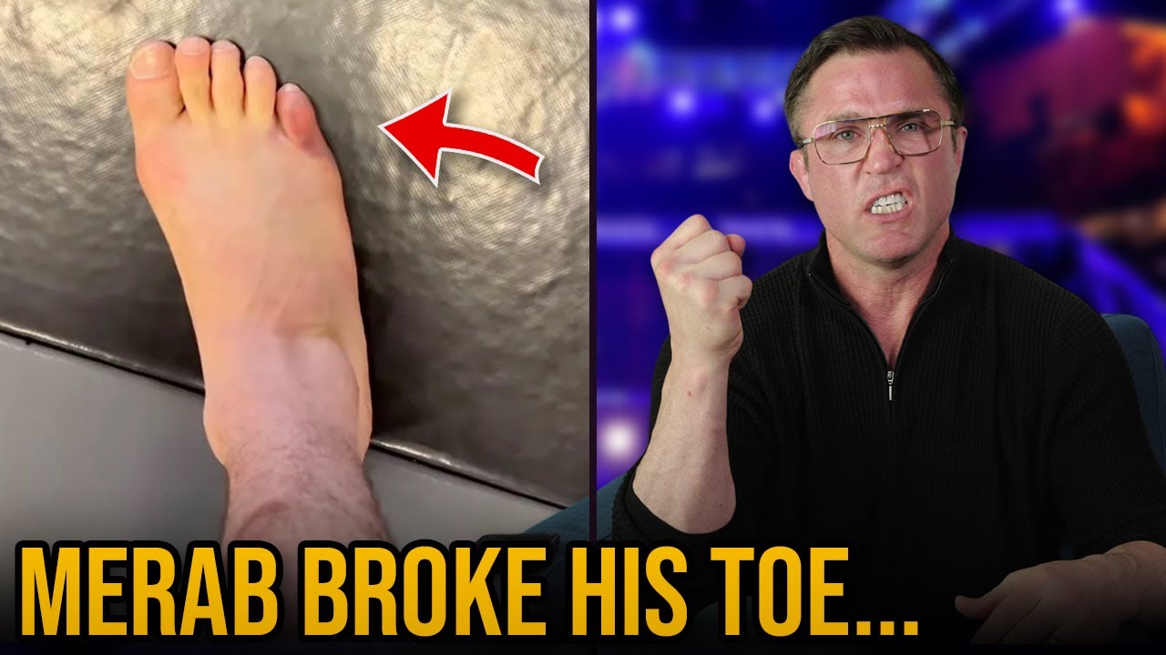 Conor and Merab Broke their Toes, BUT Merab Still Wants to Fight ...
