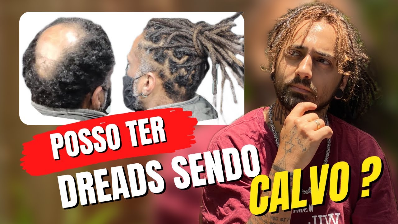 Posso ter dreads sendo calvo ? - Dread e calvície - YouTube