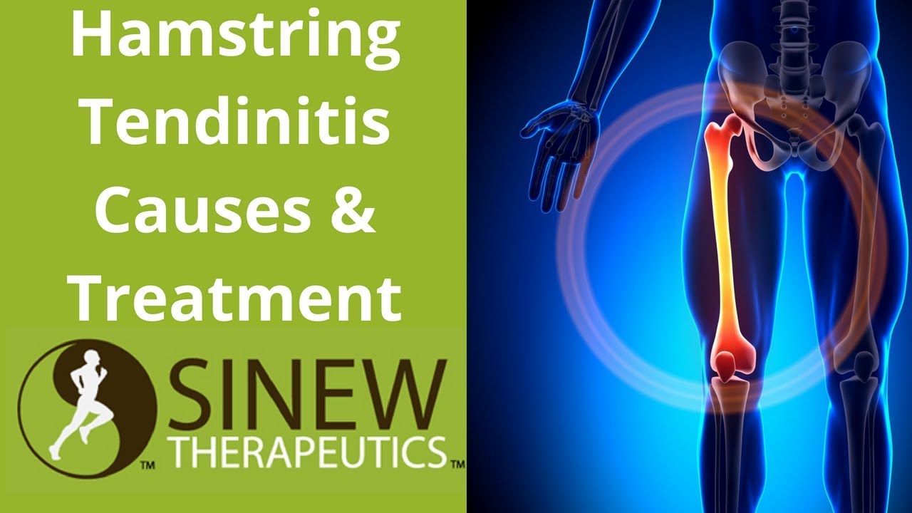 Hamstring Tendinitis Causes and Treatment - YouTube