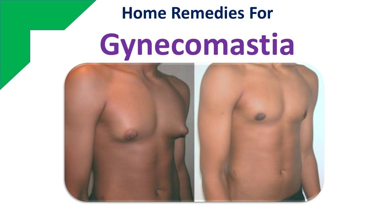 Home Remedies For Gynecomastia With Turmeric Youtube