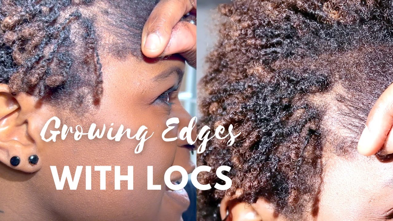 GROWING THIN EDGES WITH STARTER LOCS | MICRO LOCS | BRAID/TWIST LOCS # ...