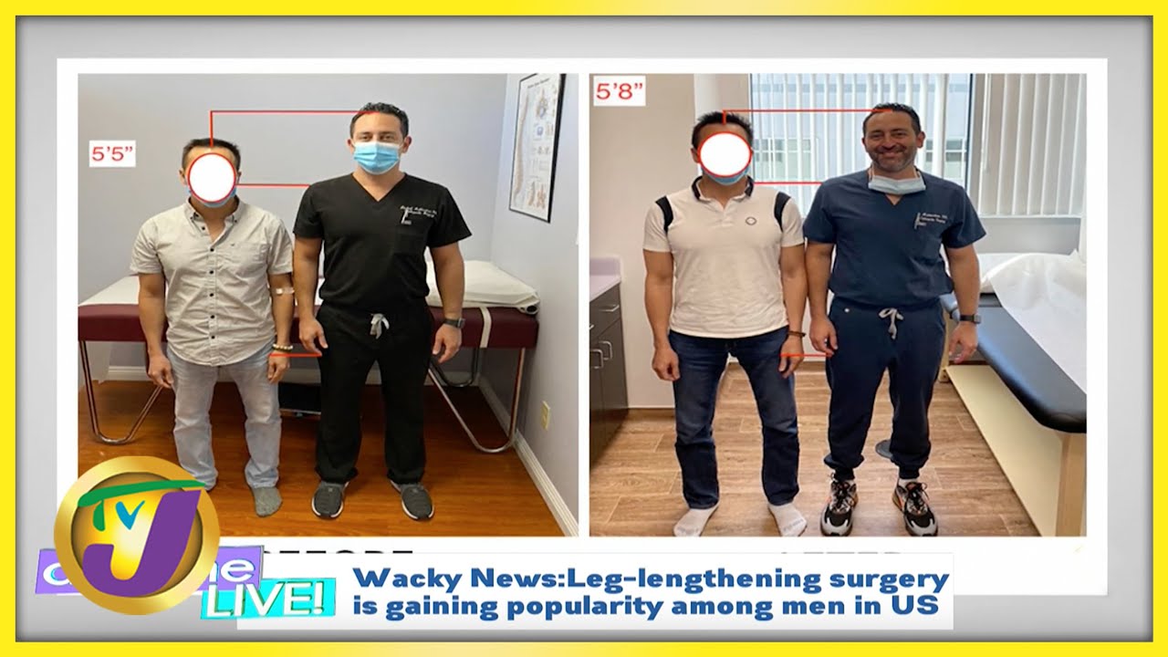 Wacky News: Leg-lengthening Surgery is Gaining Popularly among men in ...