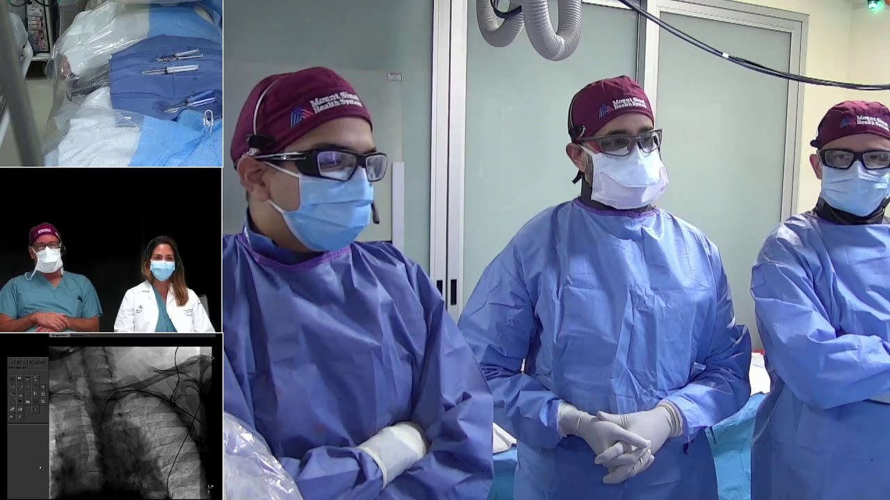 Transradial Partial Splenic Embolization and Reduction with Onyx Liquid ...