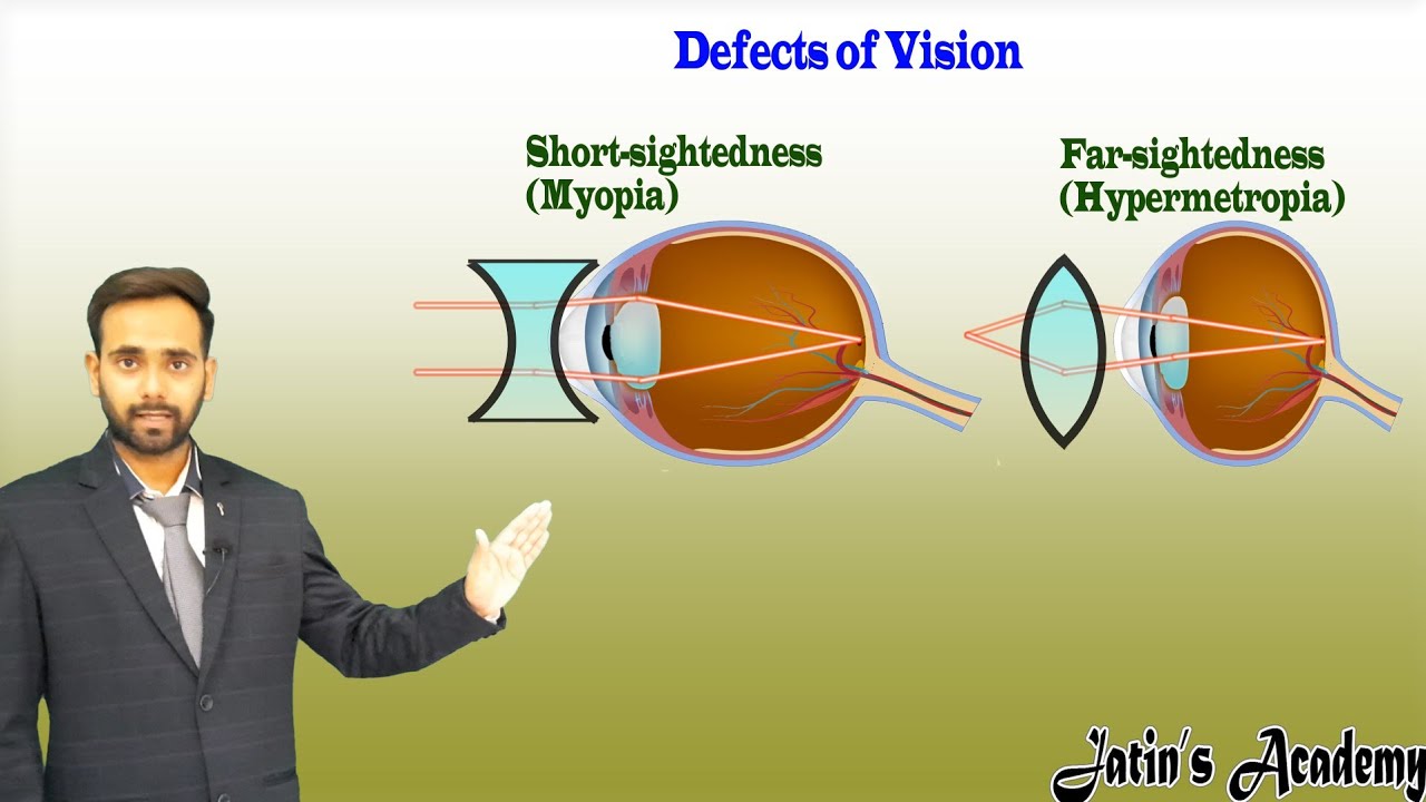 Defects of Vision Its causes and correction Animated Videos-Jatin ...
