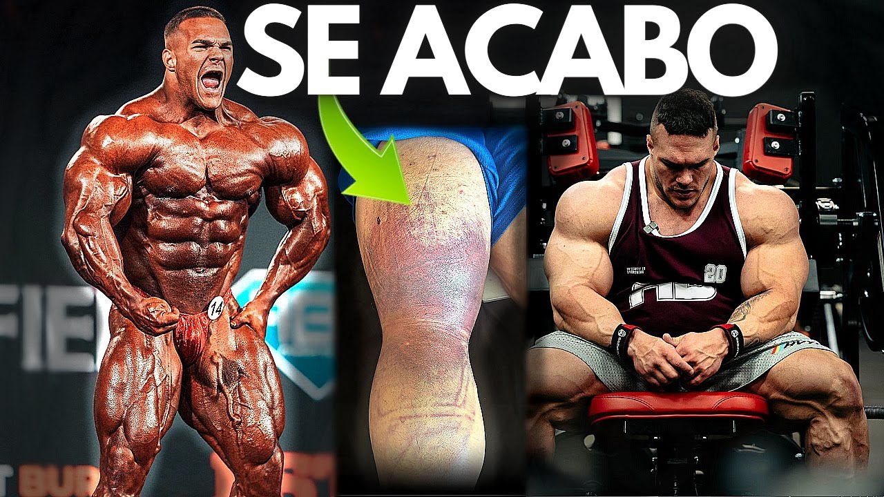 NICK WALKER SE LESIONA Y DICE ADIOS AL MR OLYMPIA 2023 - Culturismo ...