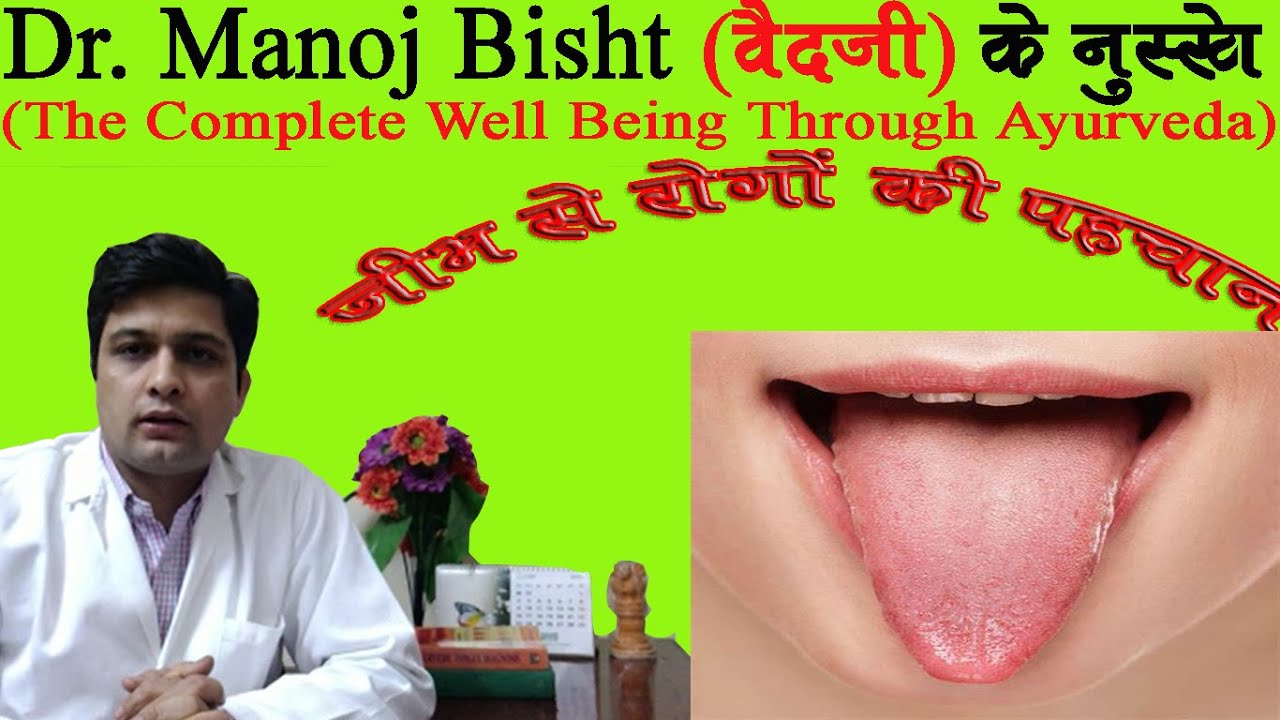 Dr. Manoj Bisht - 3 (जीभ से रोगों की पहचान) - YouTube