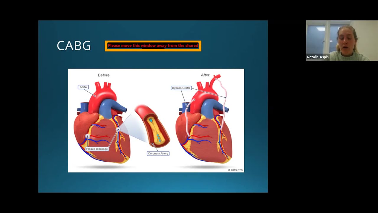 Cardiac Speciality Teaching - YouTube