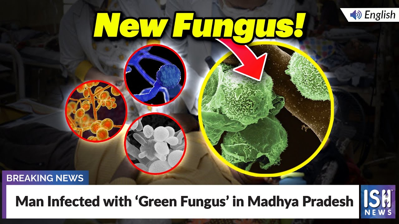 Man Infected with ‘Green Fungus’ in Madhya Pradesh - YouTube