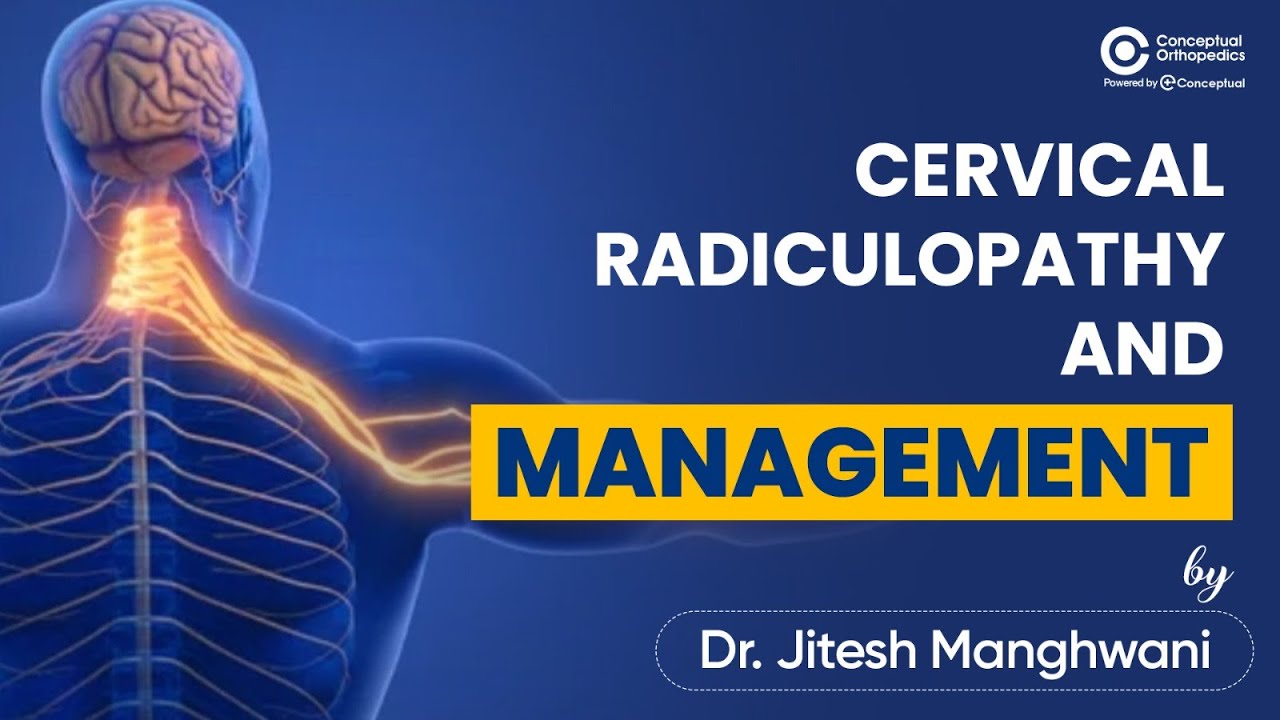 Neck Nerve Pain? Understanding Cervical Radiculopathy | Dr. Jitesh ...