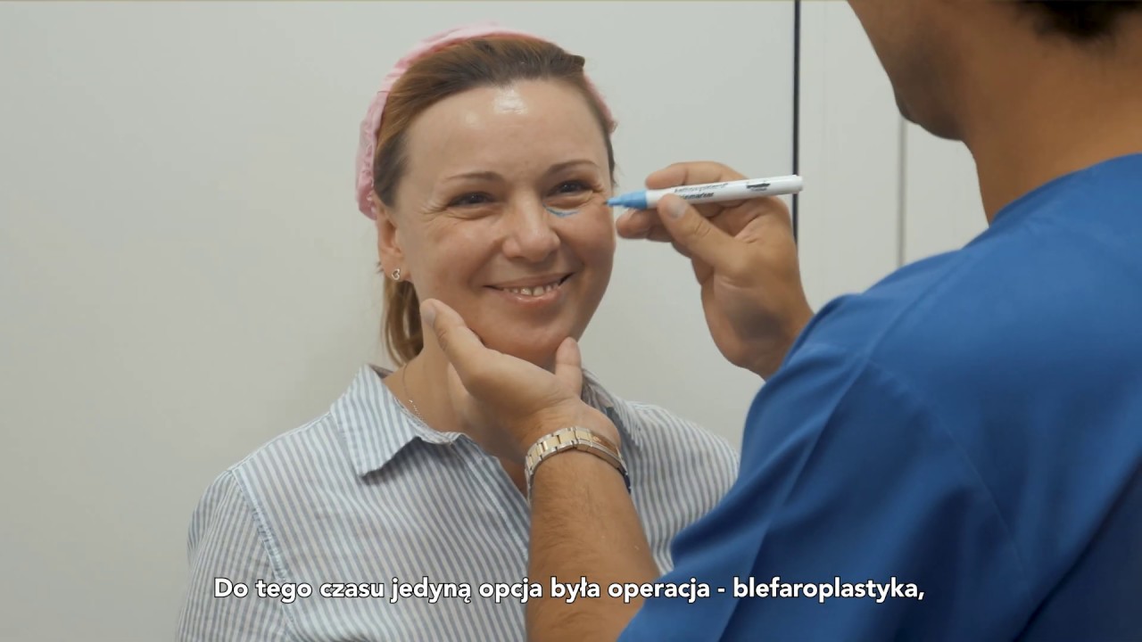 Plastyka powieki dolnej bez skalpela AccuTite Inmode - pokaz zabiegu dr ...