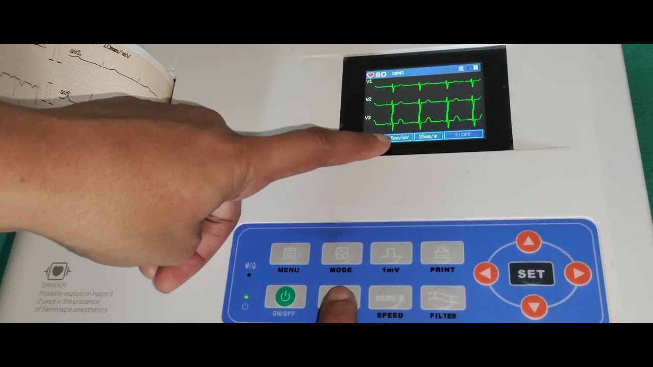 contec 3 channel ECG machine 300GA model complete demo and training ...