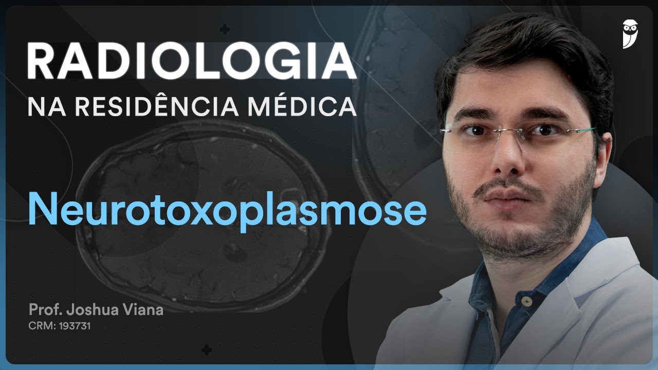 Neurotoxoplasmose | Radiologia na Residência Médica - YouTube