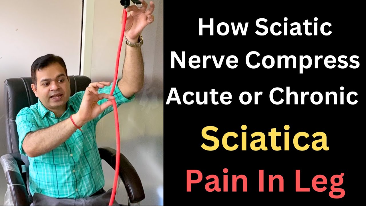 Acute or Chronic Sciatica, Nerve Compression, Leg Pain Relief, Sciatica ...