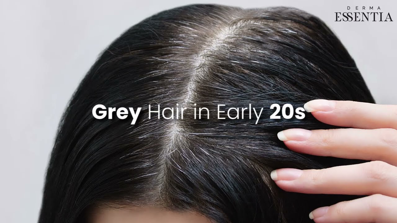 Revive First Grey Hair with result-oriented | Derma Essentia Trichoedge ...