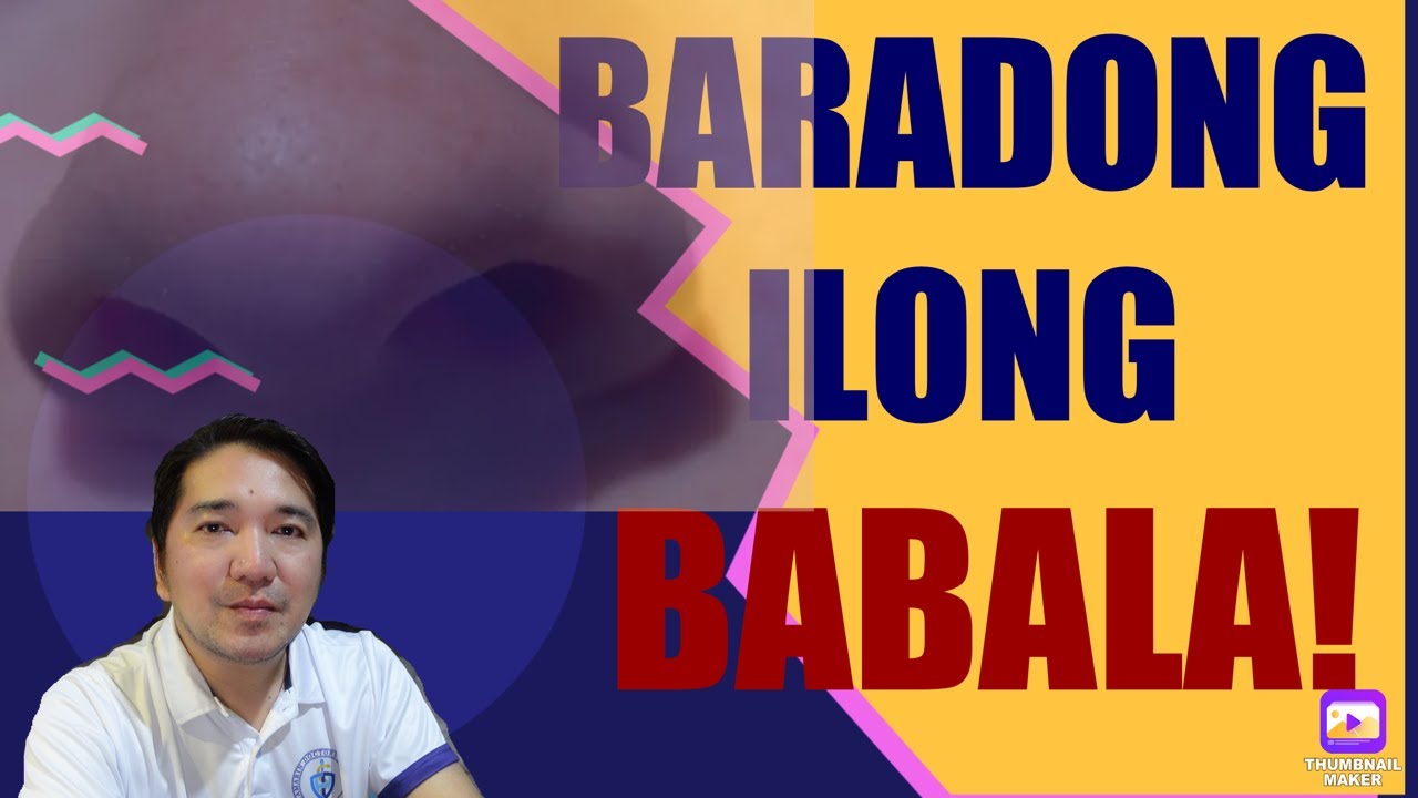 ALIS BARADO TIPS - YouTube