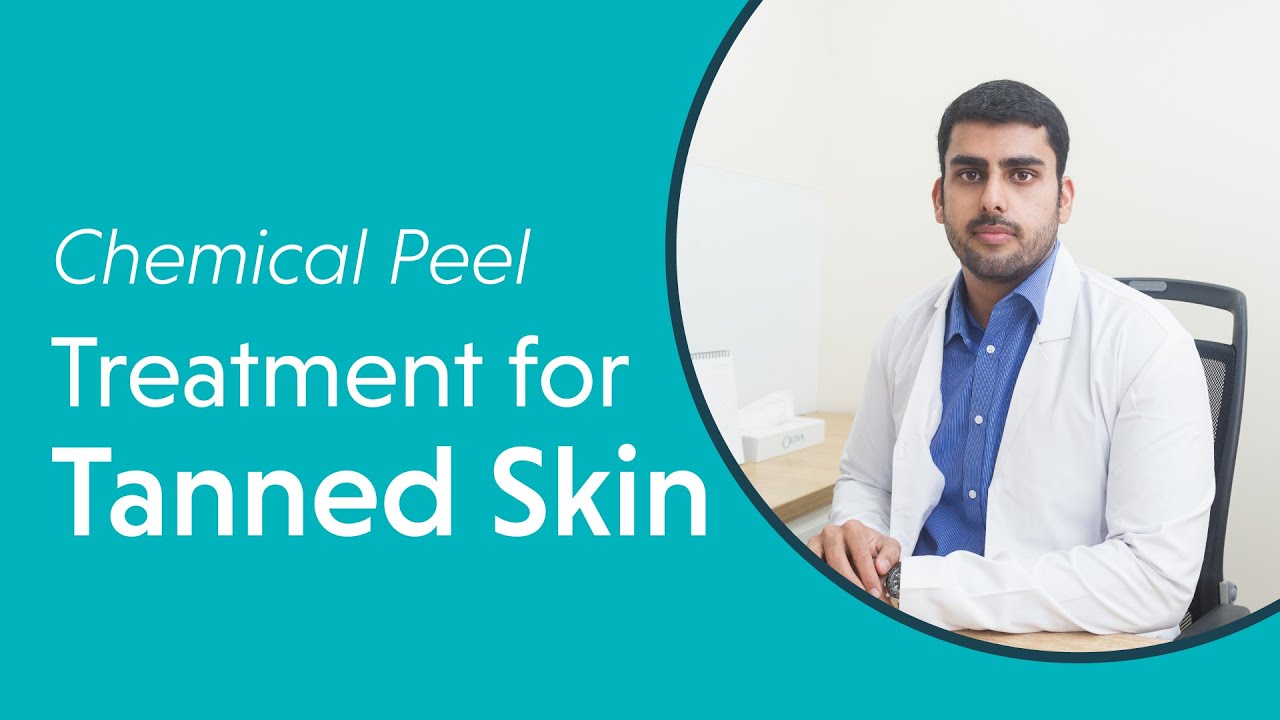 Transform Your Skin Proven Chemical Peel Treatment for Tanned Skin at ...