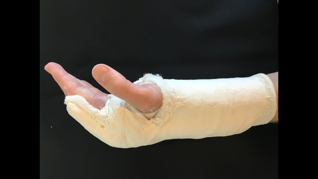 CMMS Intrinsic Plus Fabrication - YouTube