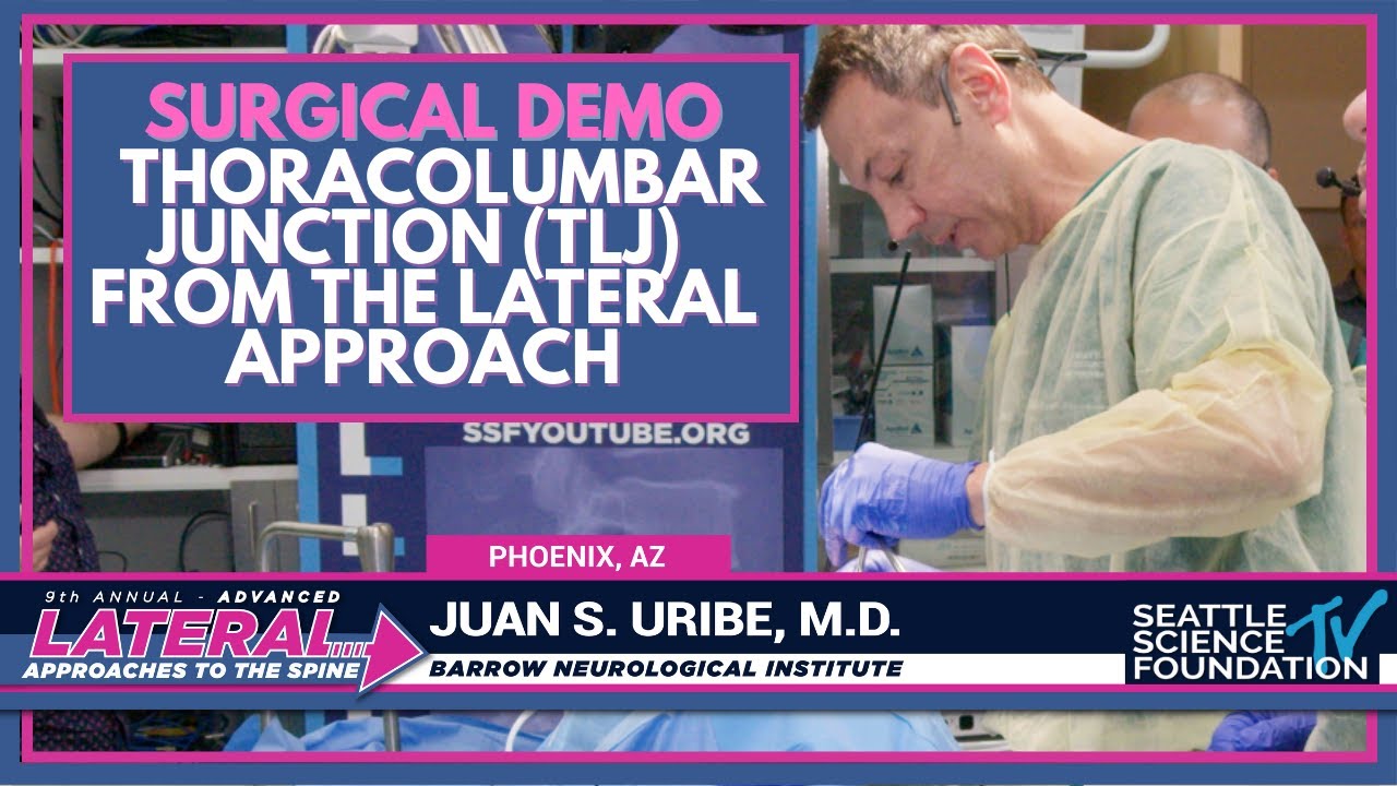 Thoracolumbar Junction TLJ from the Lateral Approach - Juan S Uribe, M ...