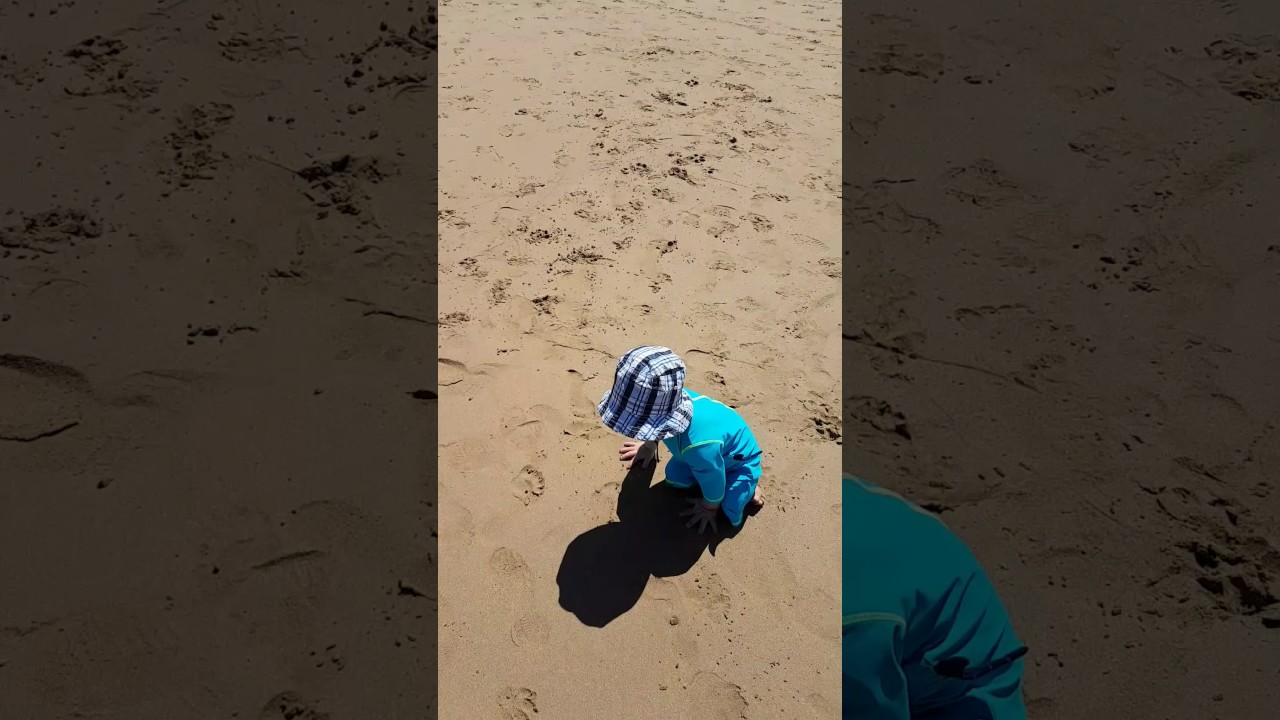 Oliver - Toddler Amputee - Crawling 6 weeks after operation - YouTube