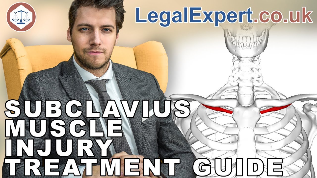 Subclavius Muscle Injury Treatment Guide ( 2019 ) UK - YouTube