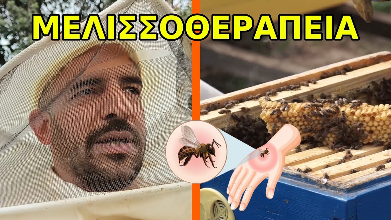 ΜΕΛΙΣΣΟΘΕΡΑΠΕΙΑ🐝Με Δηλητήριο Μέλισσας, ΜελισσοΒελονισμός &Εναλλακτική ...